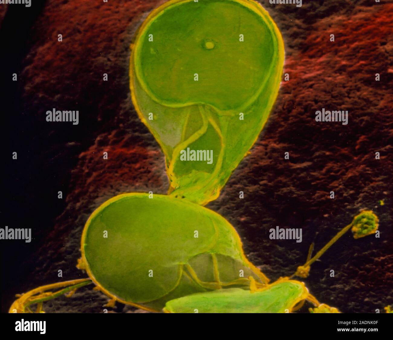 Giardia lamblia. Coloured Scanning Electron Micro- graph (SEM) of the ...