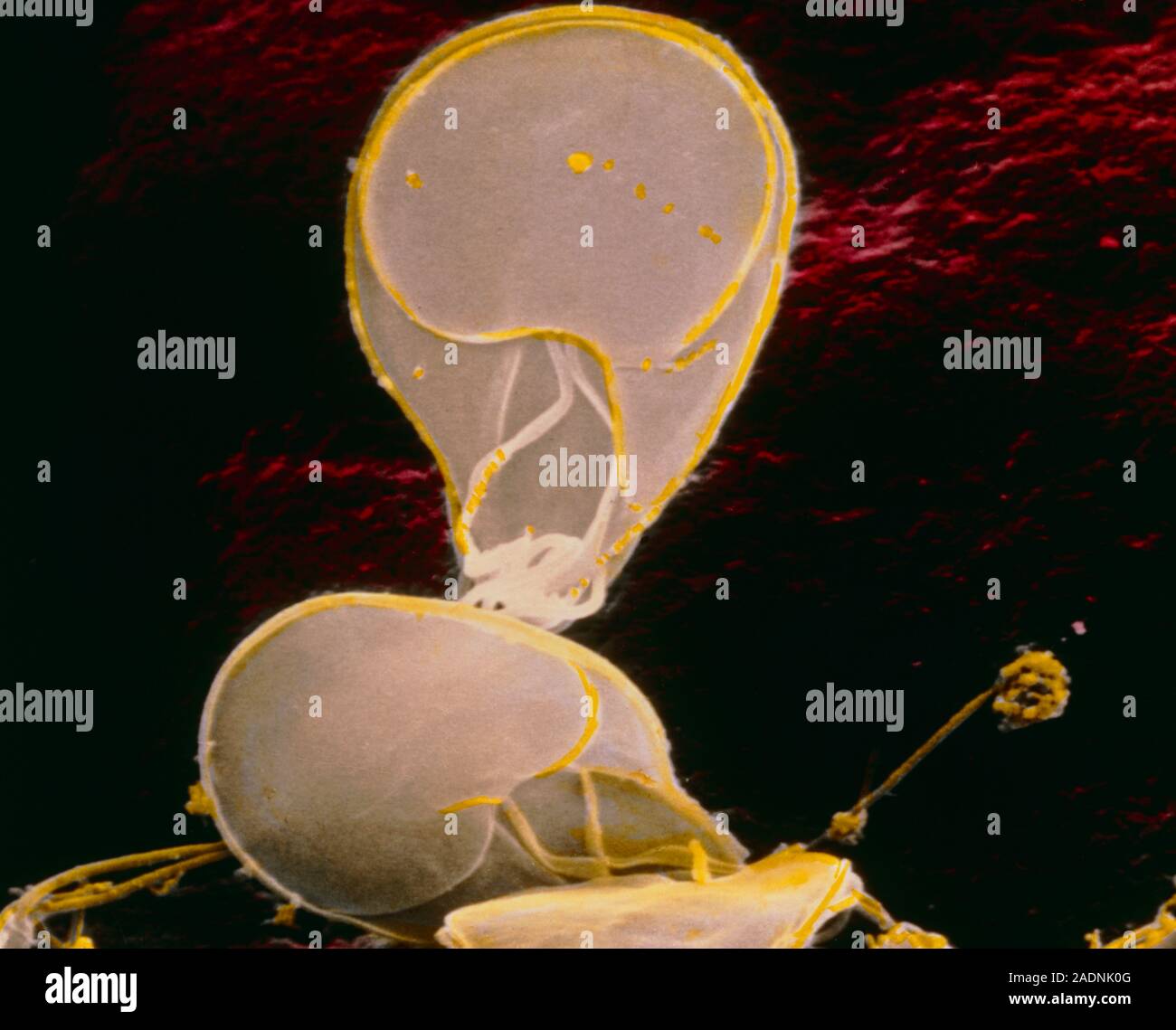Giardia lamblia. Coloured Scanning Electron Micro- graph (SEM) of the ...
