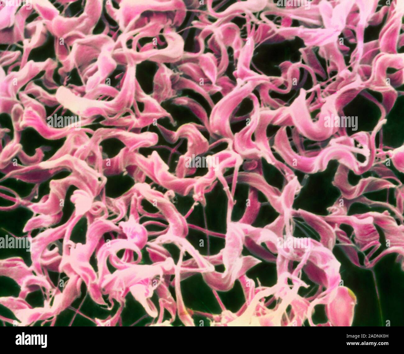Trypanosoma sp. Colour scanning electron micrograph of a tangle of ...