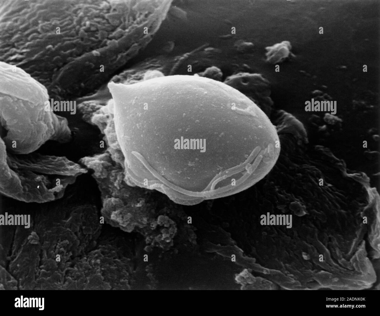 Trichomonas vaginalis. Scanning electron micrograph of the parasitic ...