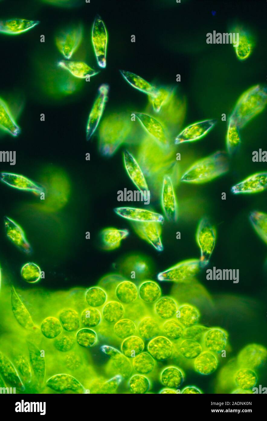 Euglena gracilis. Light micrograph of a group of the single celled ...