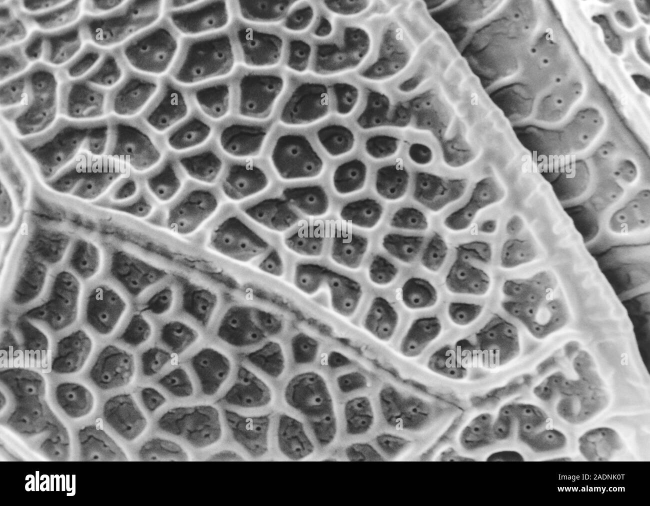 Dinoflagellate shell. Scanning Electron Micrograph (SEM) of part of the ...