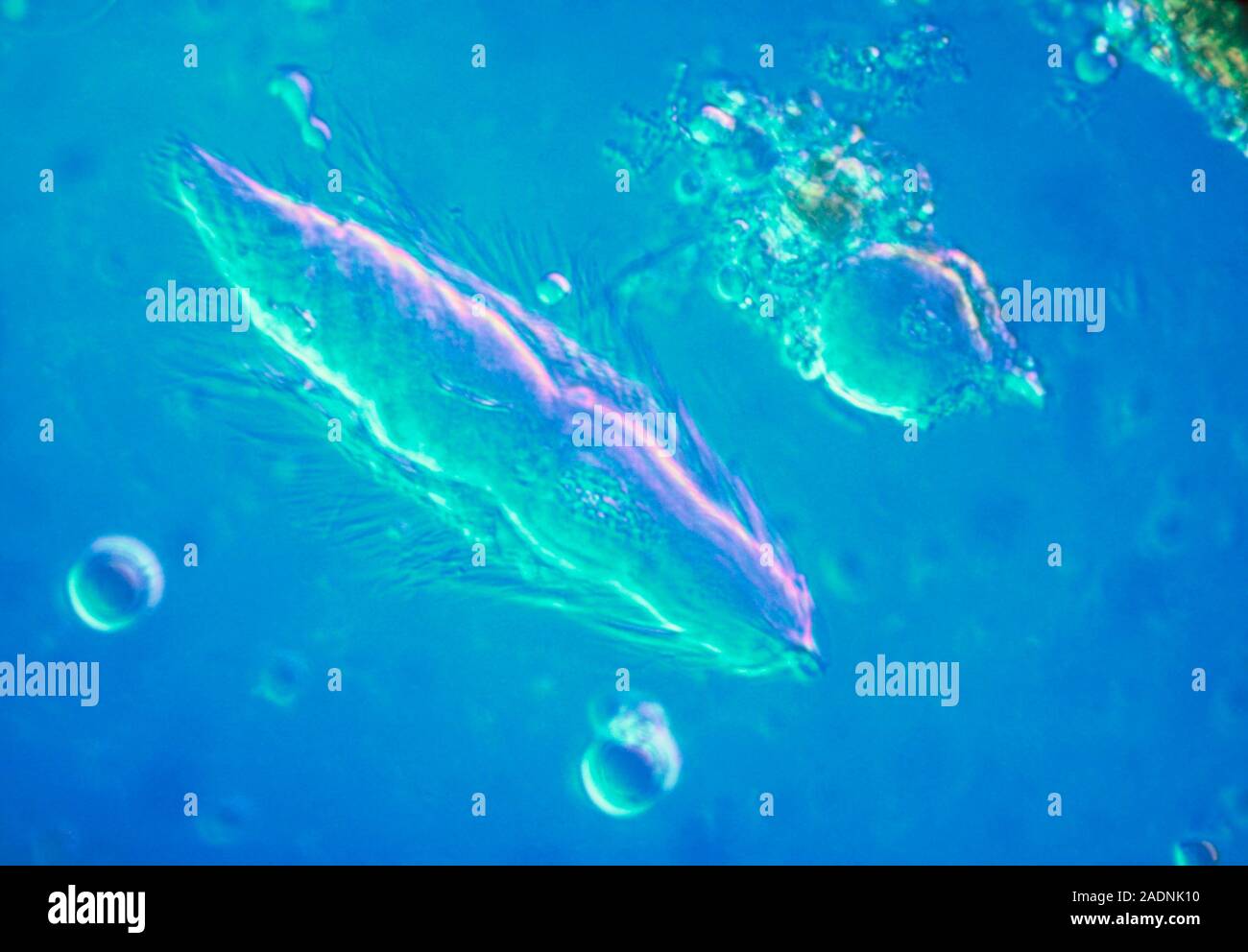 Trichonympha protozoan. Light micrograph of a Trichonympha sp ...