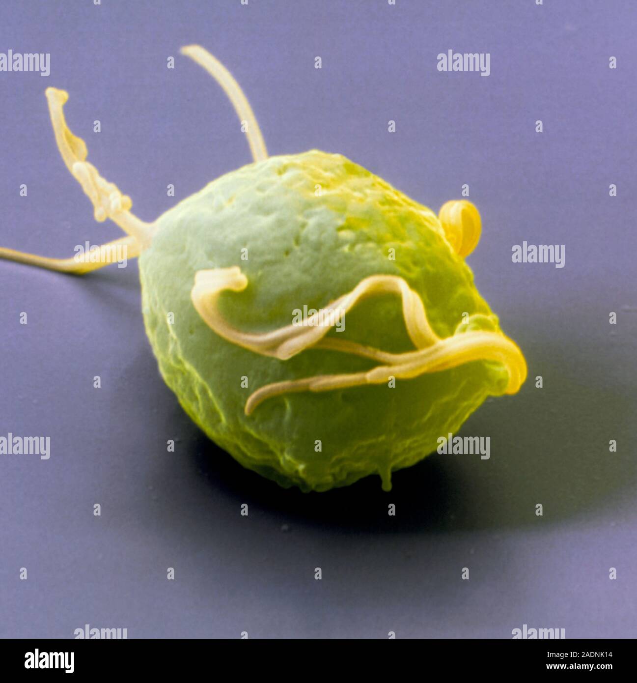 Trichomonas vaginalis. Coloured Scanning Electron Micrograph (SEM) of ...