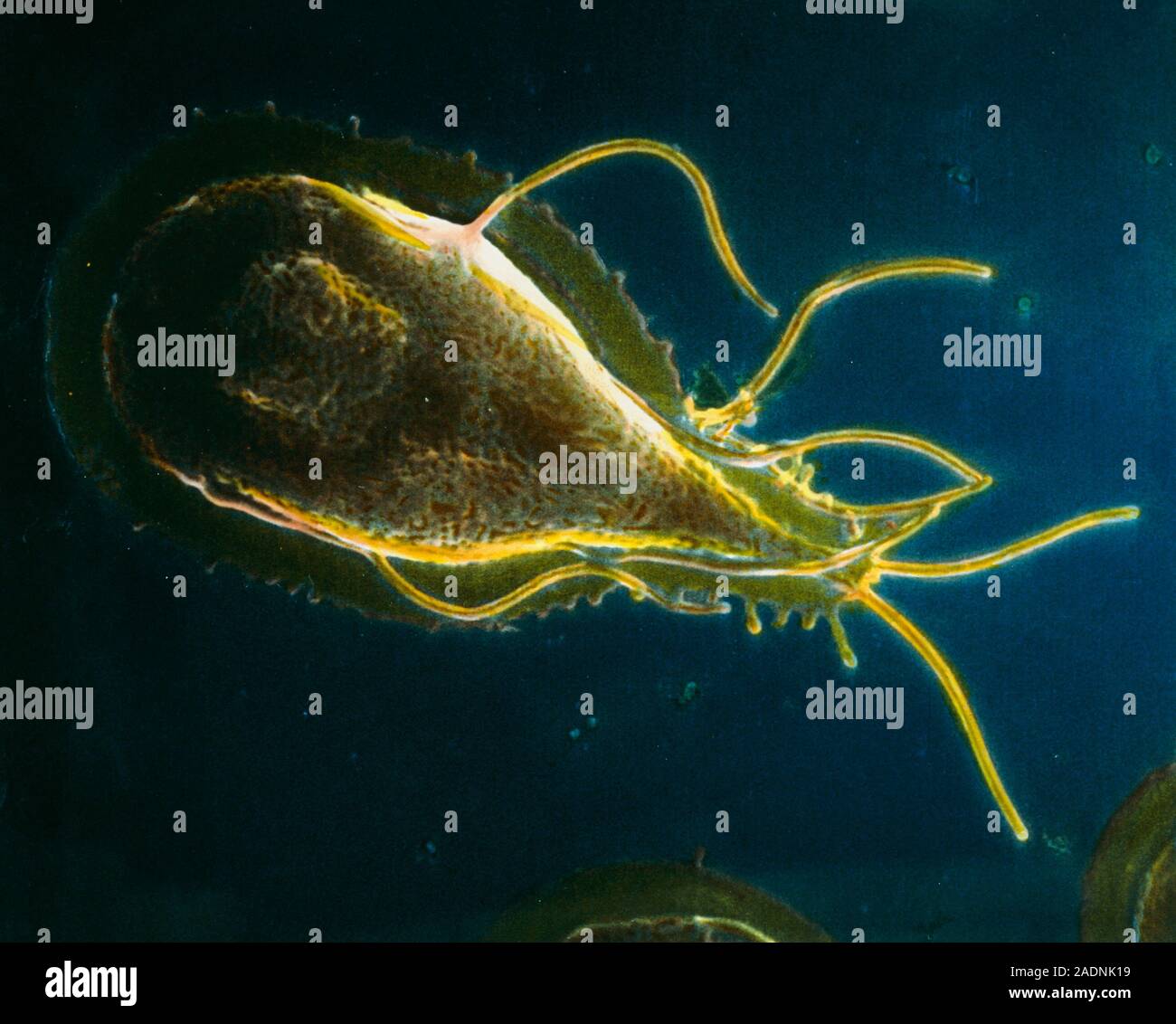 Giardia sp. protozoan. Coloured scanning electron micrograph (SEM) of ...
