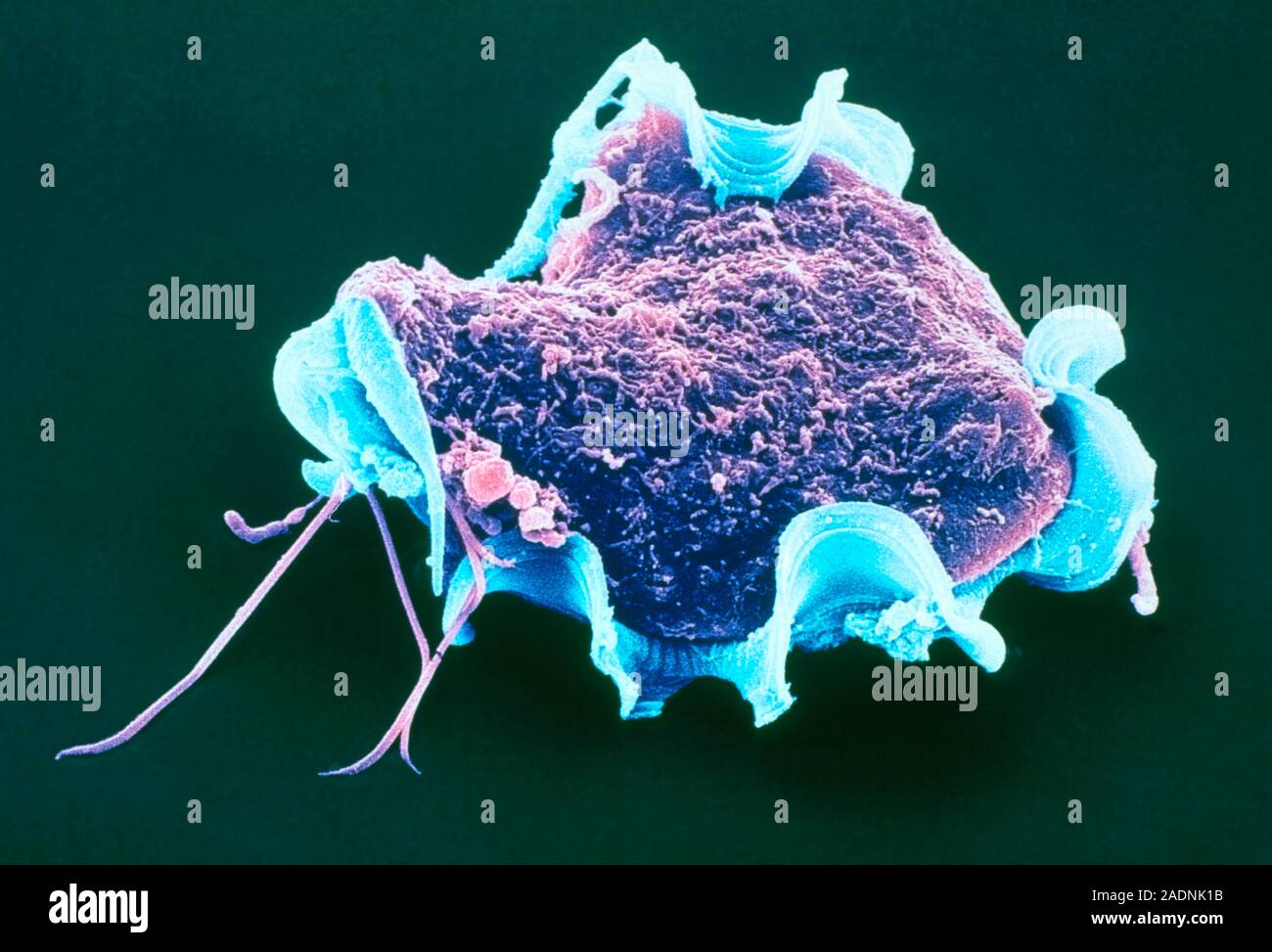 Trichomitopsis protozoan. Coloured scanning electron micrograph (SEM ...