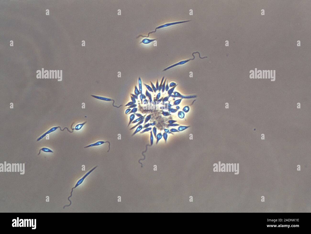 Leishmania protozoa. Light micrograph of Leishmania donovani protozoa ...