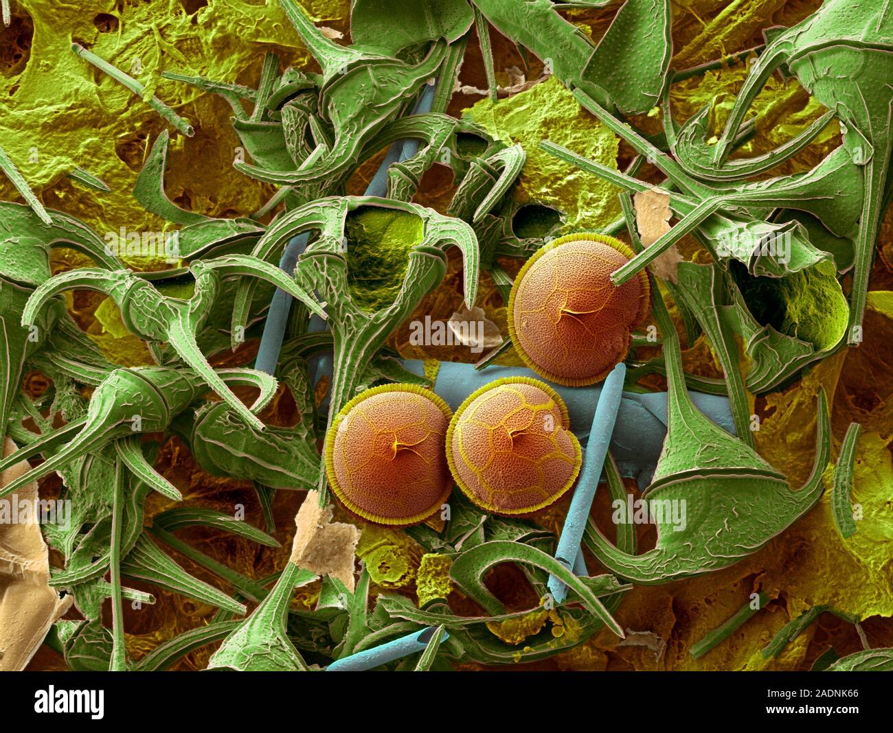 Dinoflagellates. Coloured scanning electron micrograph (SEM) of ...