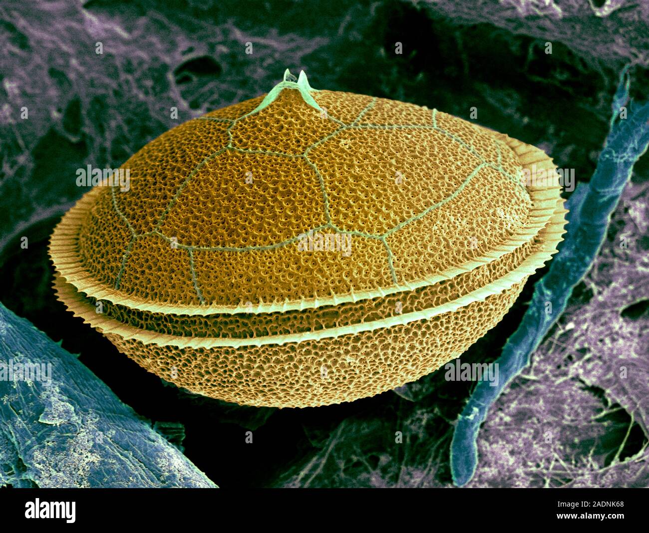 Dinoflagellate. Coloured scanning electron micrograph (SEM) of a ...
