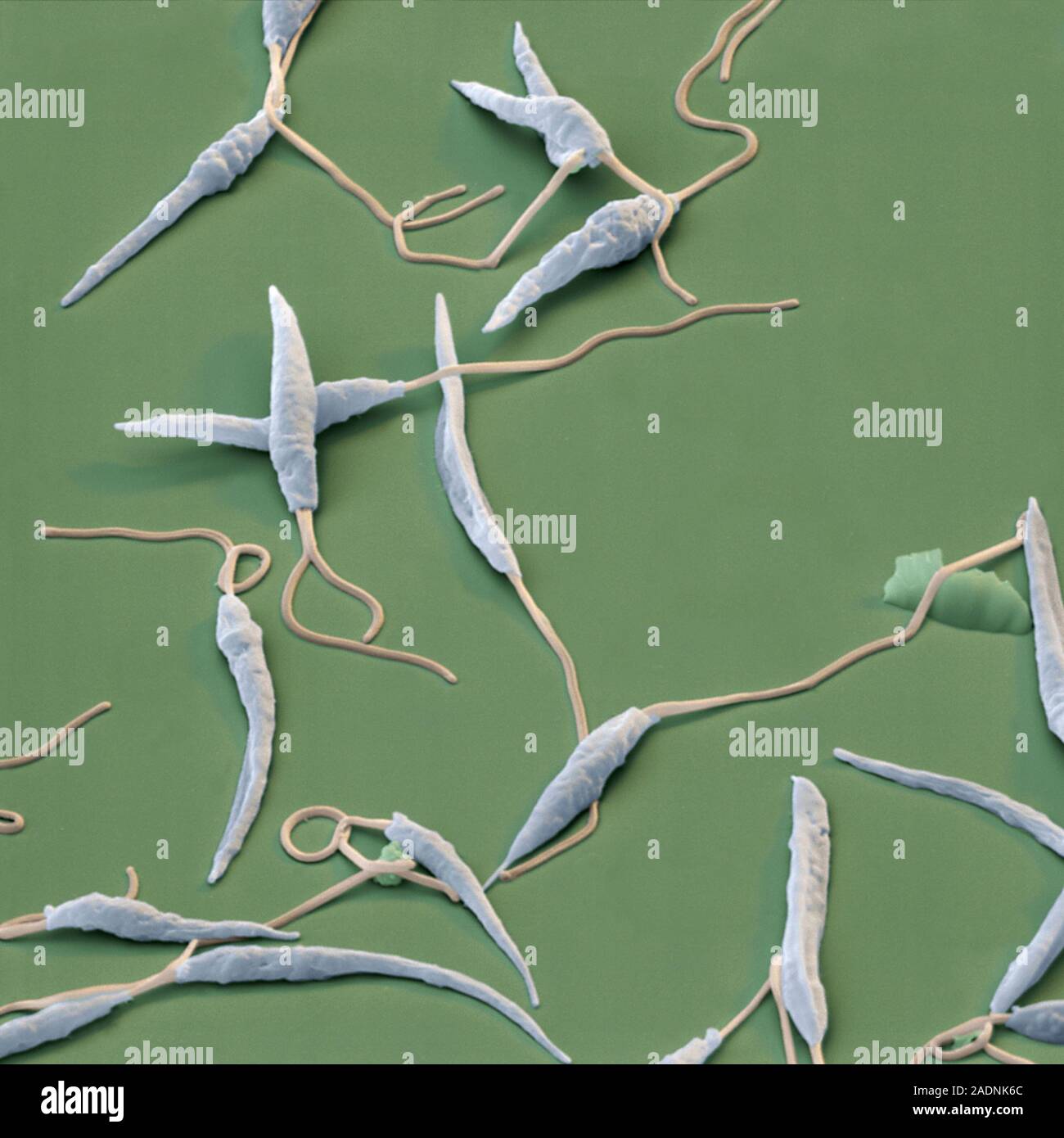 Leishmania parasites. Coloured scanning electron micrograph (SEM) of ...