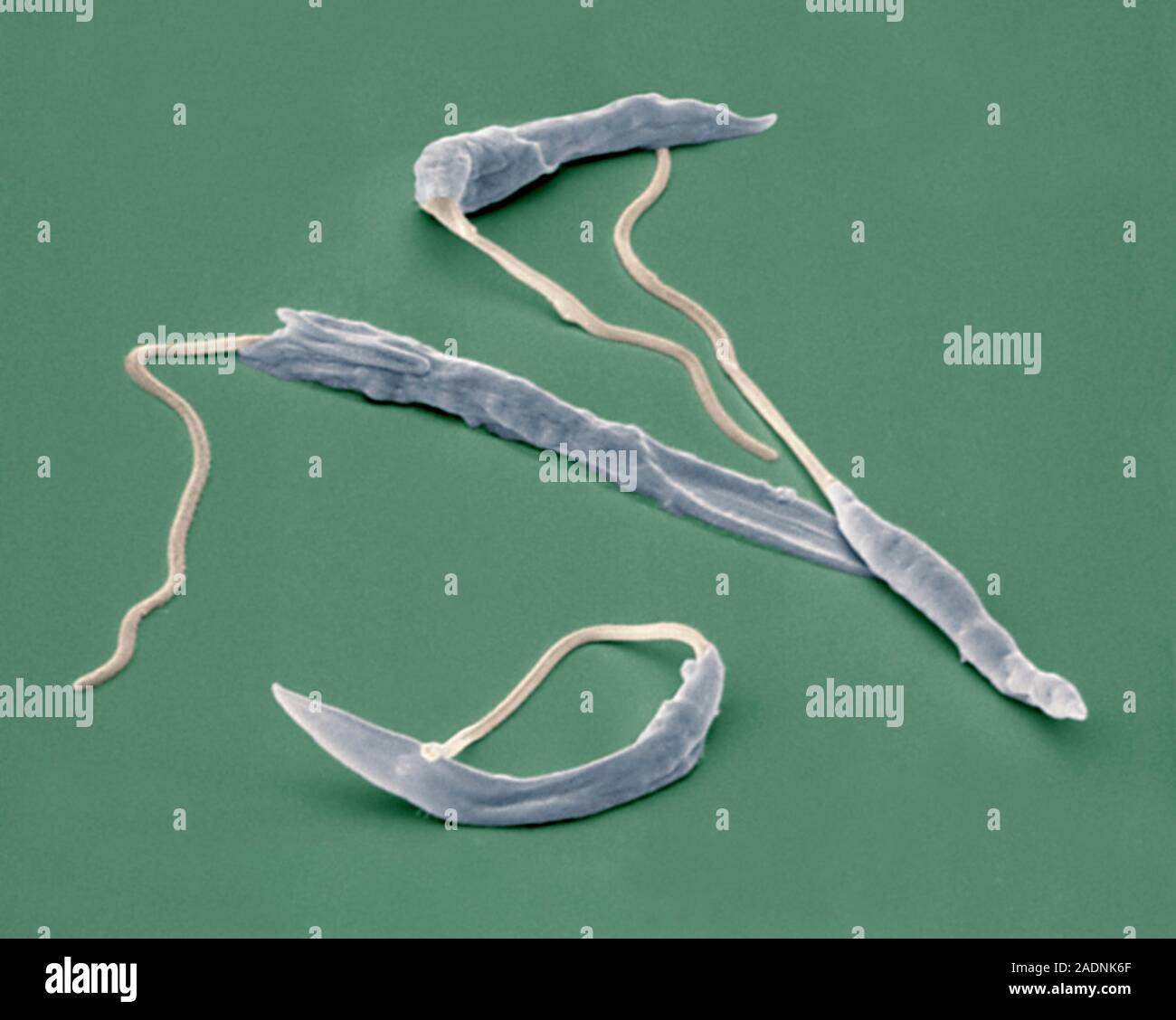 Leishmania parasites. Coloured scanning electron micrograph (SEM) of ...