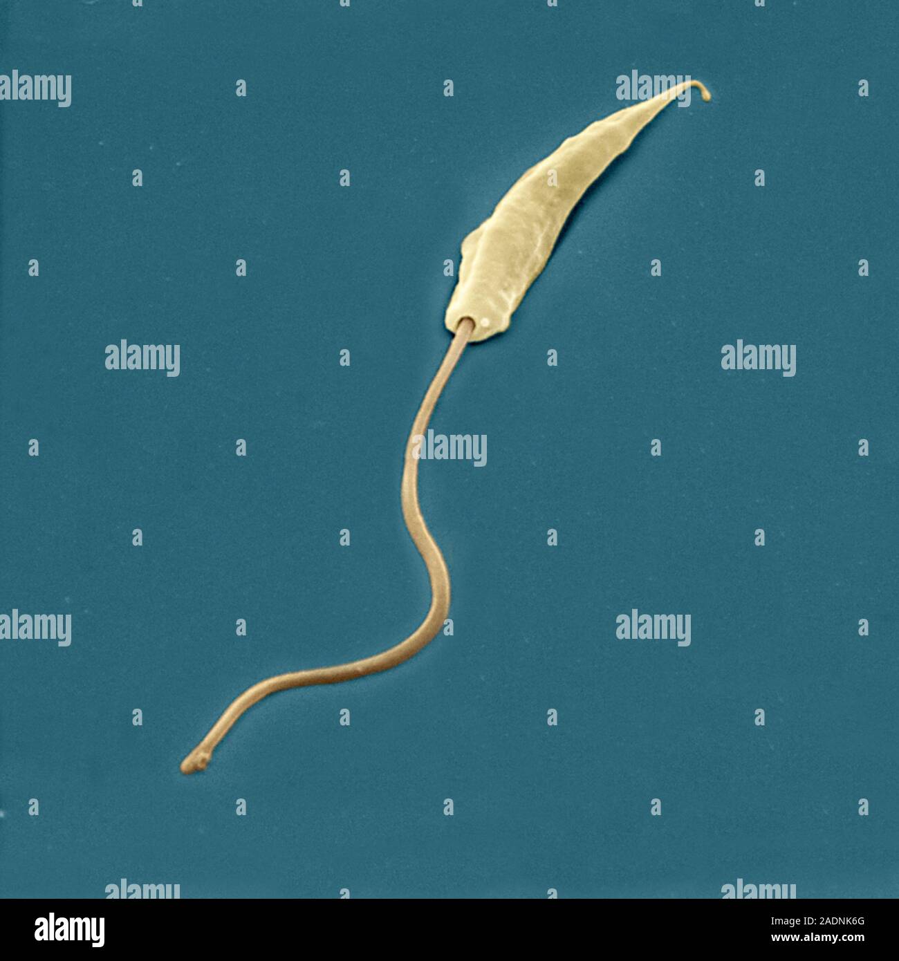 Leishmania parasite. Coloured scanning electron micrograph (SEM) of a ...