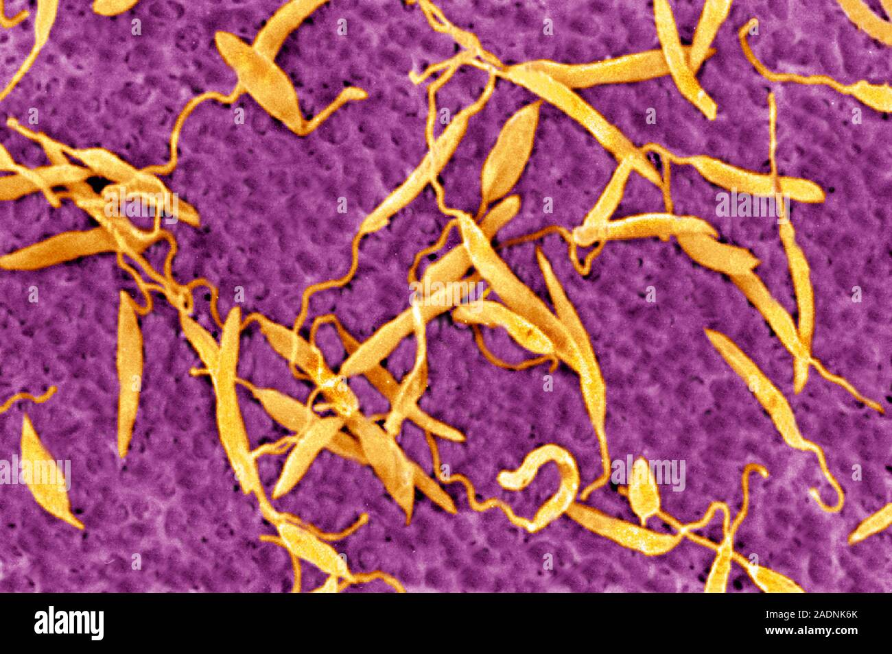 Leishmania sp. protozoa, coloured scanning electron micrograph (SEM ...