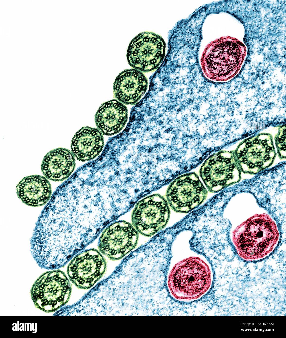 Trichonympha protozoan. Coloured transmission electron micrograph (TEM ...