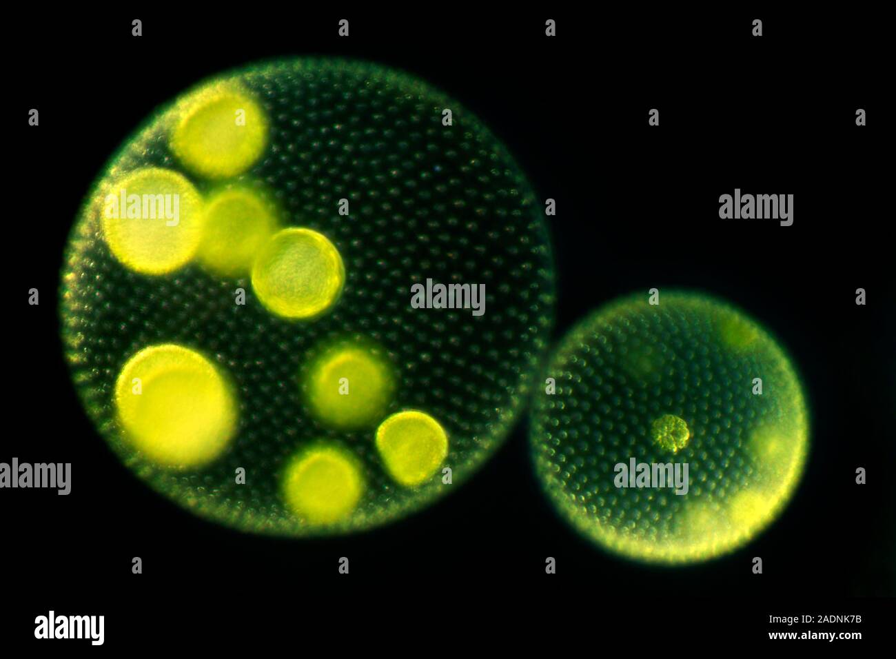 Green algae colonies. Light micrograph of green algae cells (Volvox sp ...