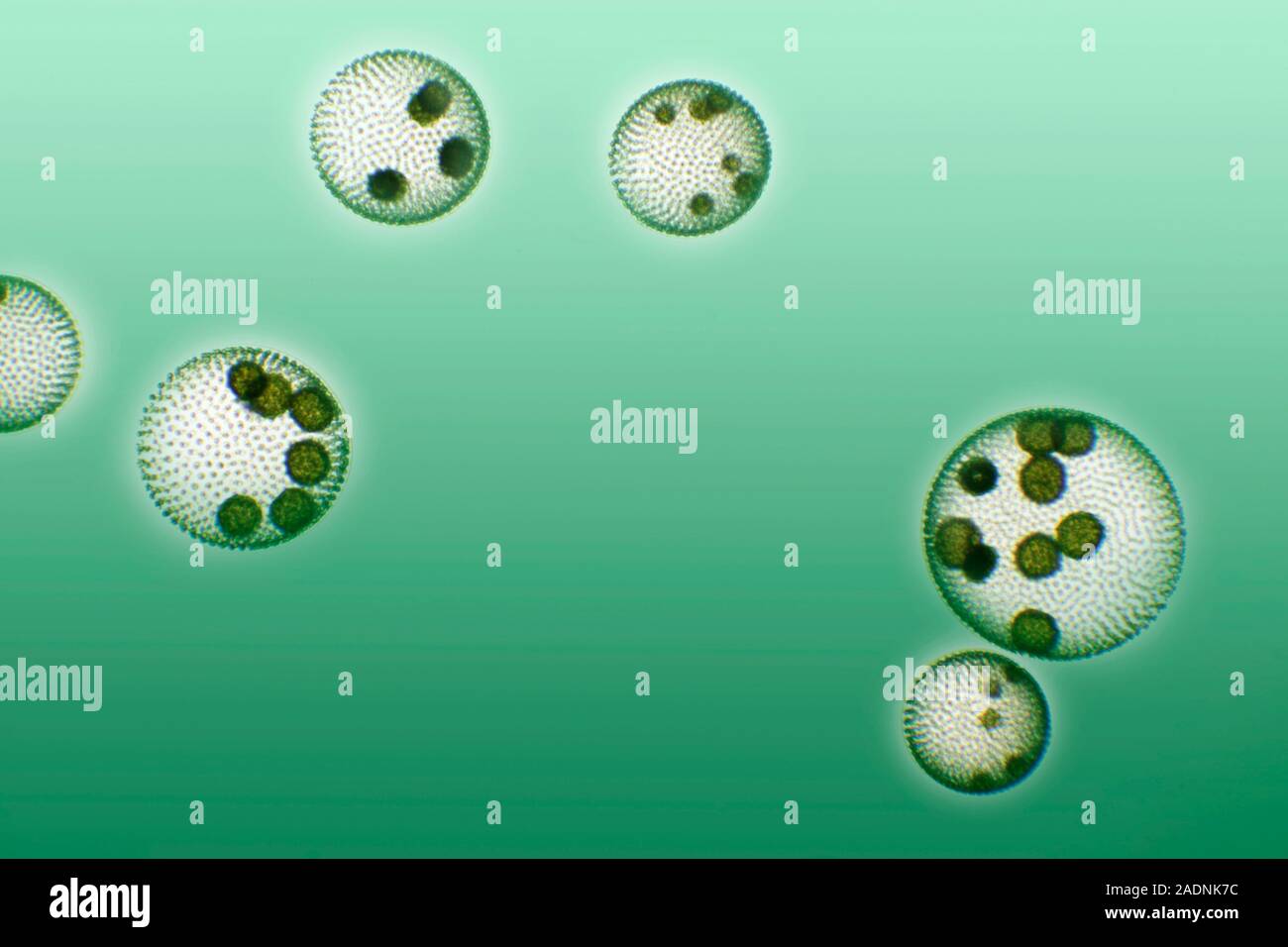Green algae colonies. Light micrograph of green algae colonies (Volvox ...