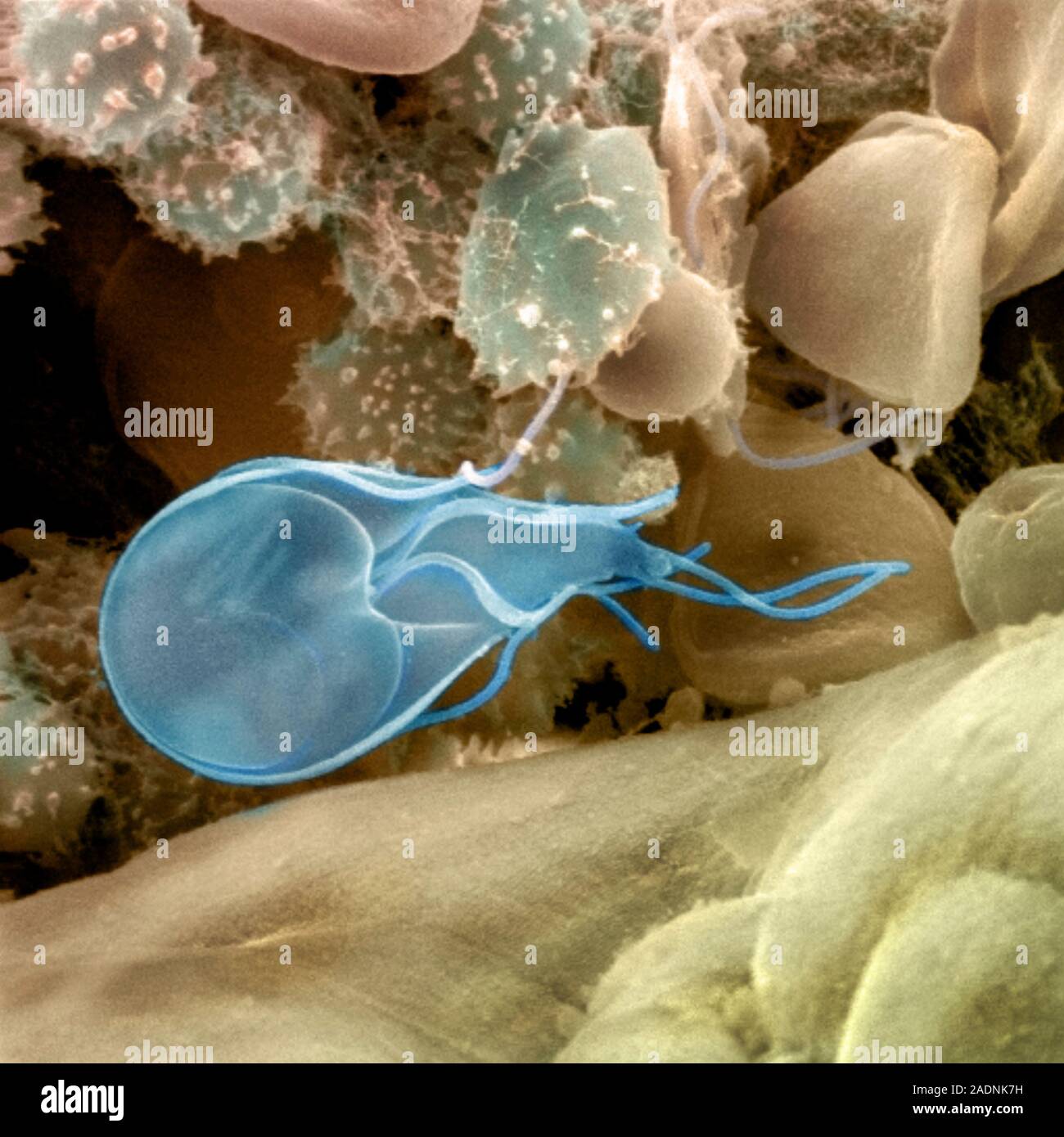 Giardia lamblia protozoan (blue), coloured scanning electron micrograph ...