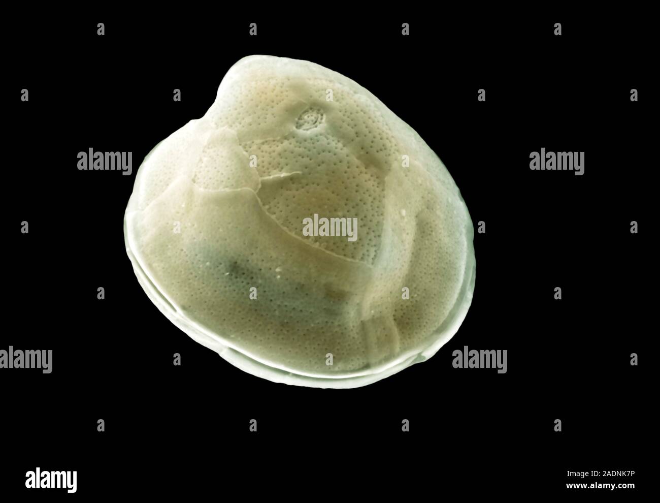 Ciguatera dinoflagellate. Coloured scanning electron micrograph (SEM ...