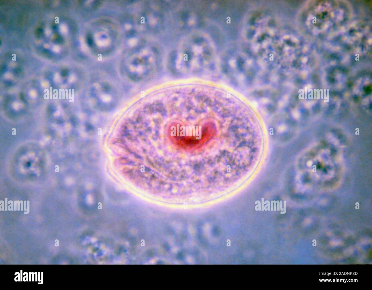 Balantidium protozoan. Light micrograph of the ciliate protozoan ...