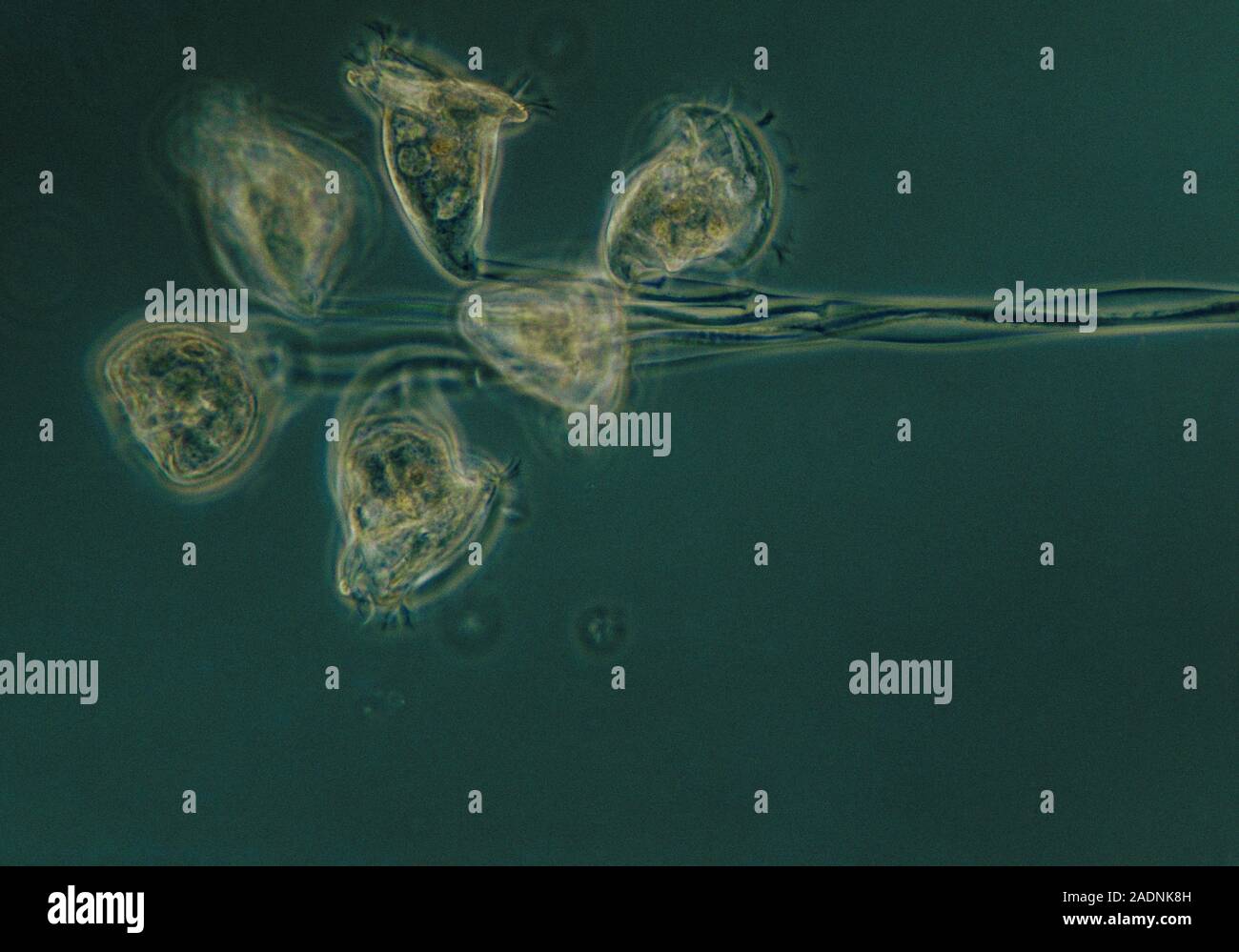 Light micrograph of the ciliate protozoa Carchesium sp. Magnification ...
