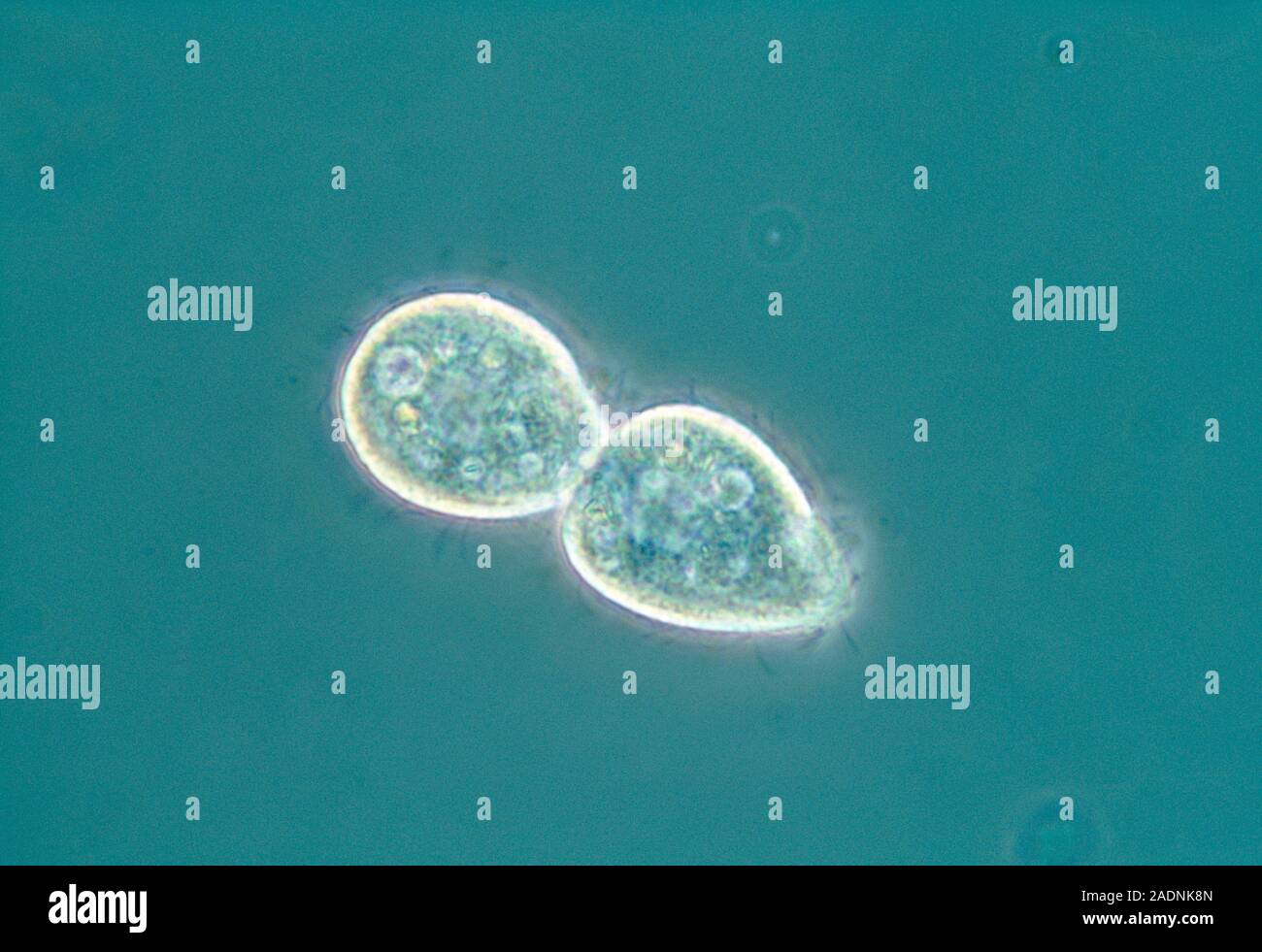 Light micrograph of the ciliate protozoa Tetrahymena sp. Magnification ...