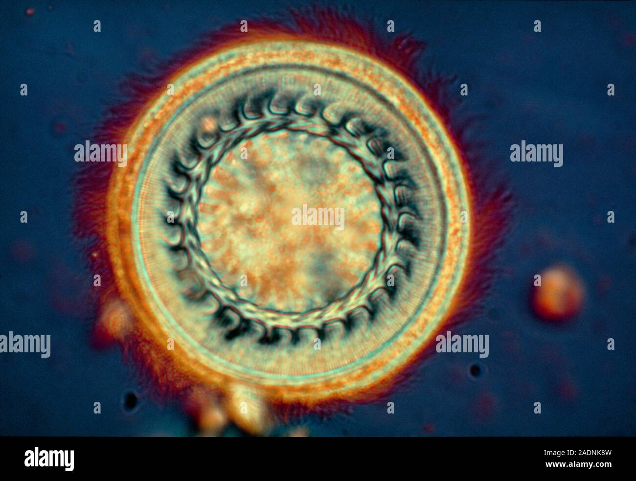 Polarised light micrograph of the fish ectoparasite Trichodina fultoni ...