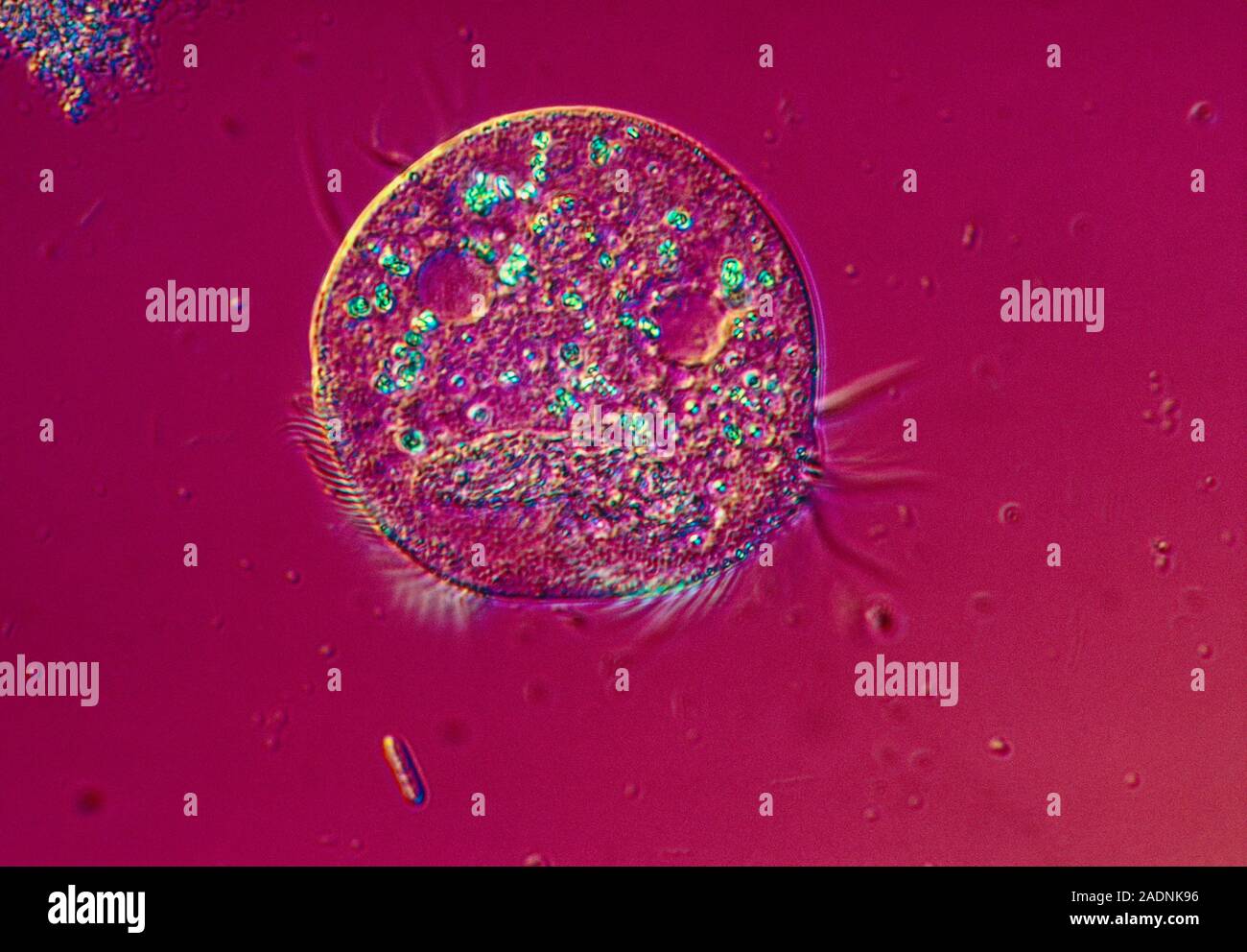 Light micrograph of the ciliate protozoan Euplotes patella, showing the ...