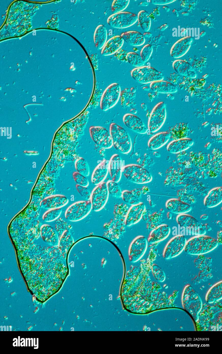 Light micrograph of a group of ciliate protozoans, Colpidium sp ...