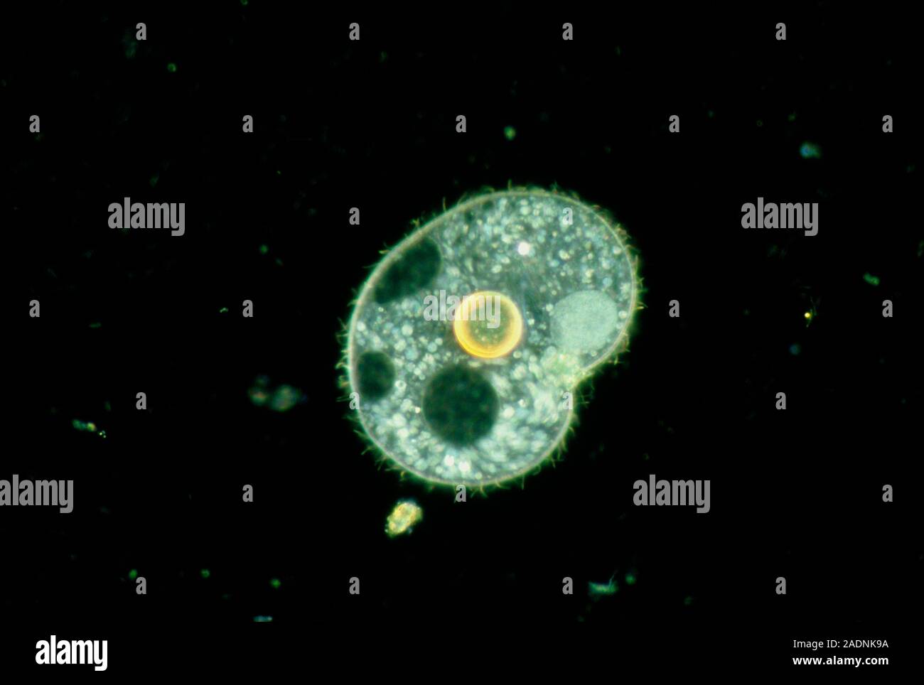 Light micrograph of an unidentified ciliate protozoan, showing its ...