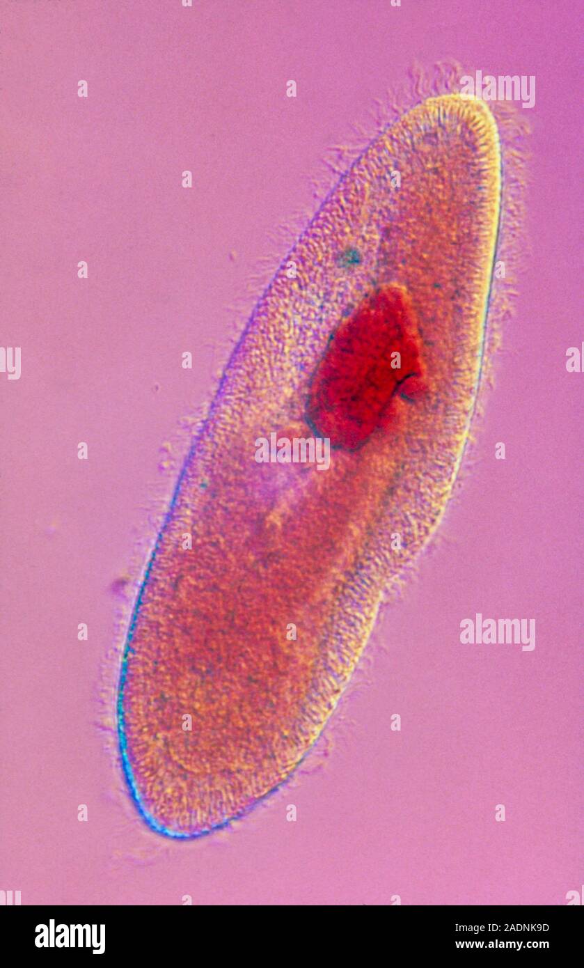 Light micrograph of the ciliate protozoan Paramecium sp., showing its macronucleus (deep pink ...