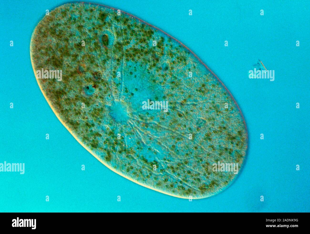 Light micrograph of the ciliate protozoan Frontonia sp., showing its ...
