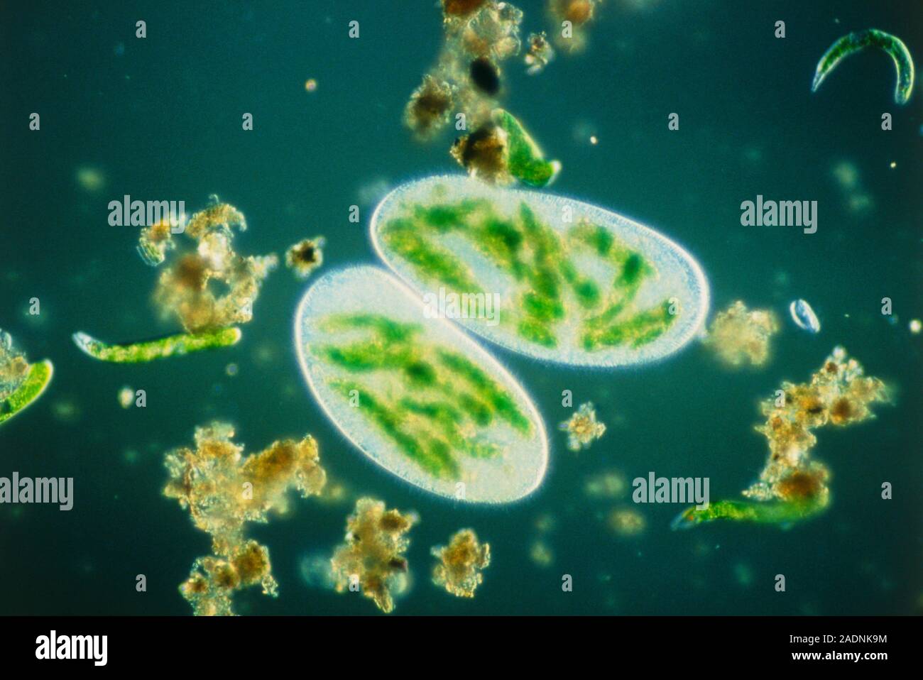 Light micrograph of two slipper-shaped, ciliate protozoans of the genus ...