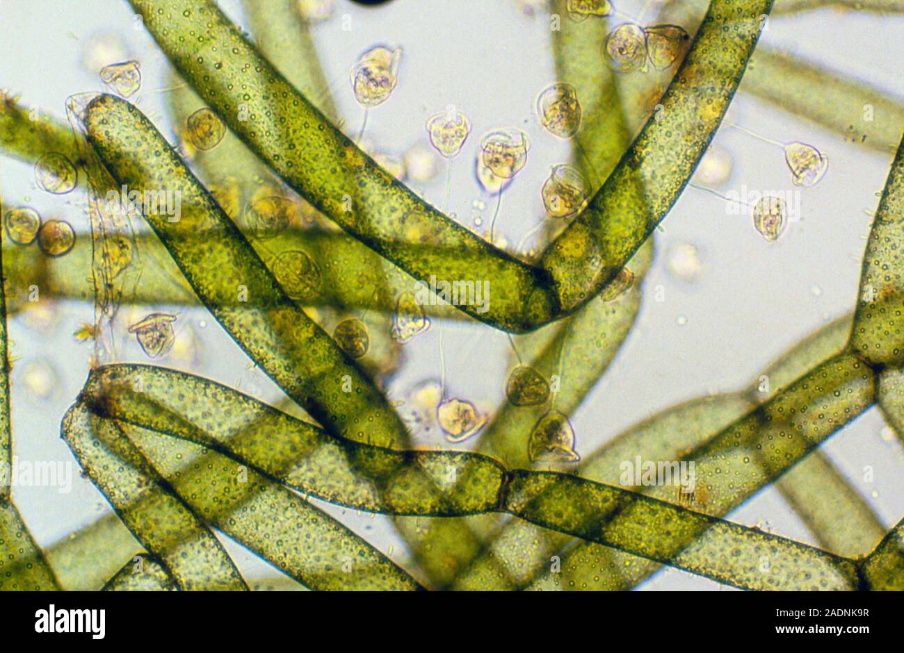 Light micrograph of a group of Vorticella (small tethered balloons ...