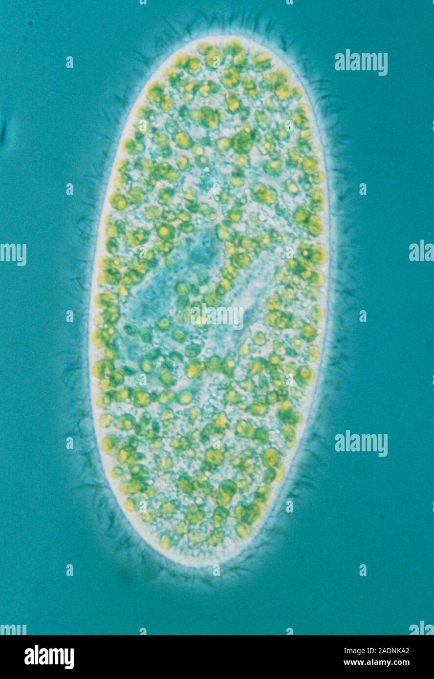 Light micrograph of a ciliate protozoan Paramecium sp. The micrograph is one in a series of four ...