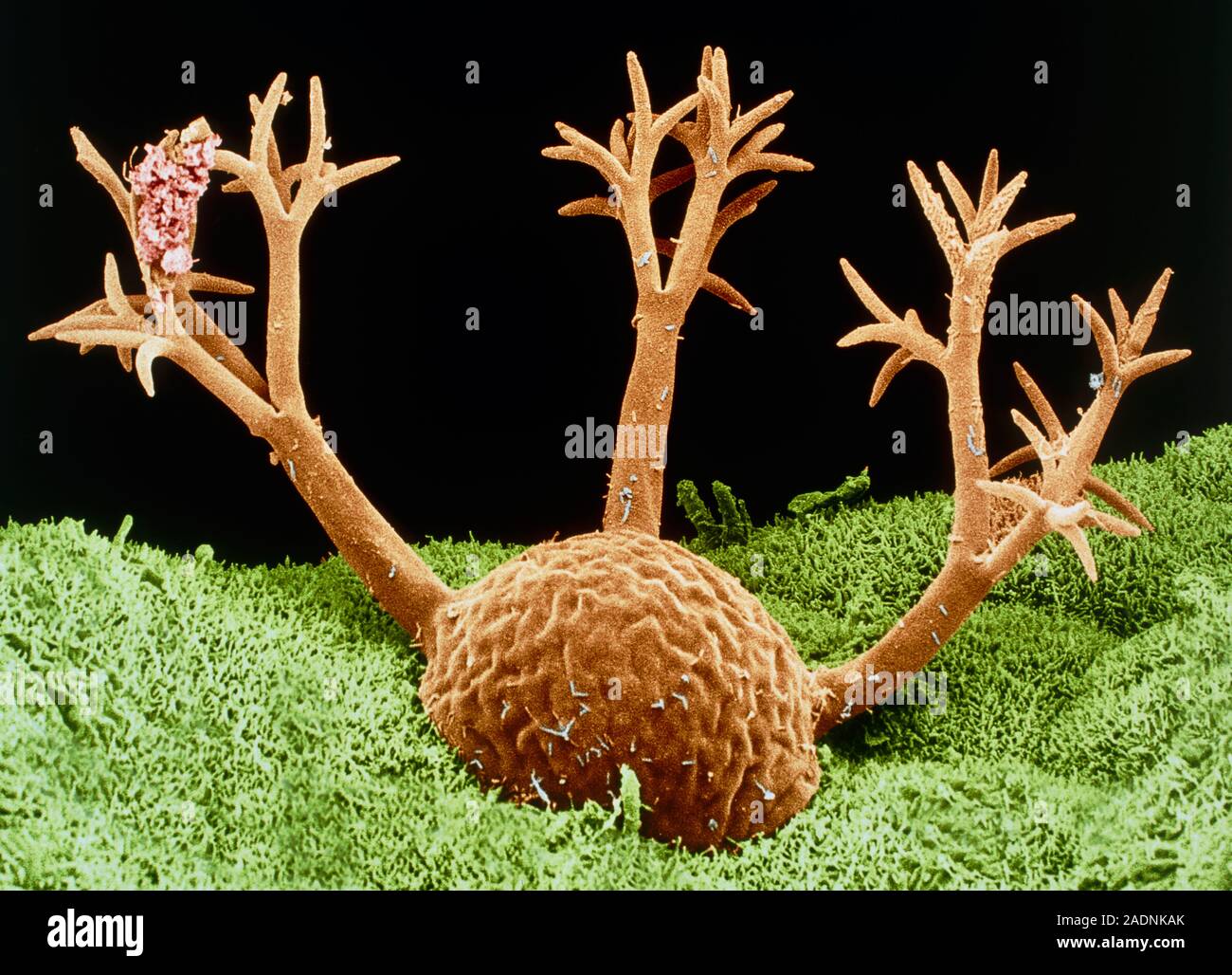 Dendrocometes protozoan. Coloured scanning electron micrograph (SEM) of ...