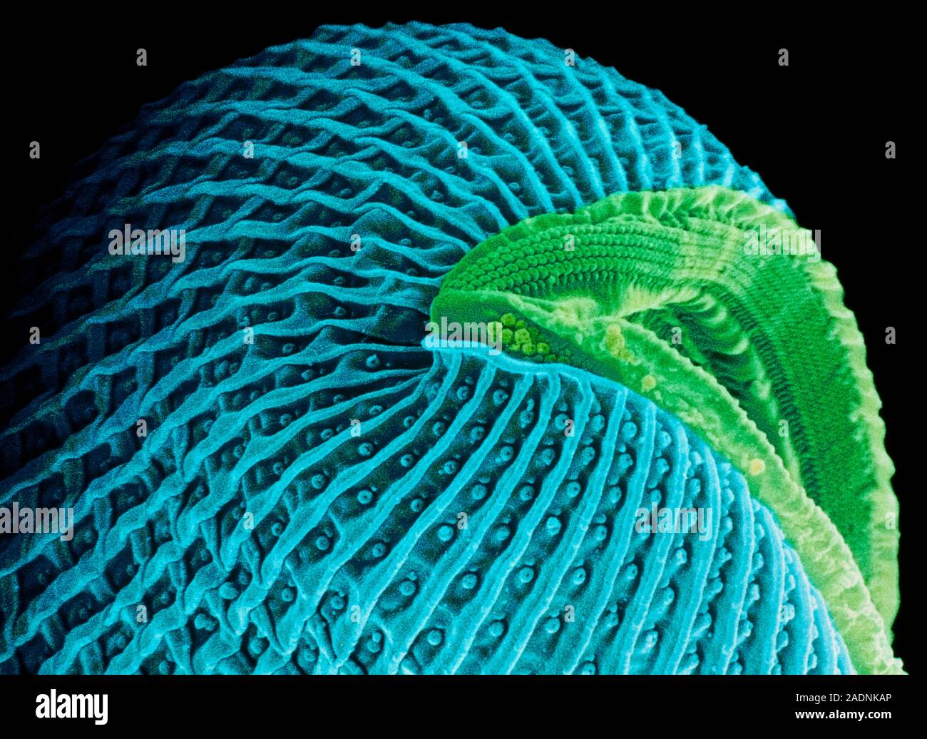 Lembadion protozoan. Coloured scanning electron micrograph (SEM) of a ...