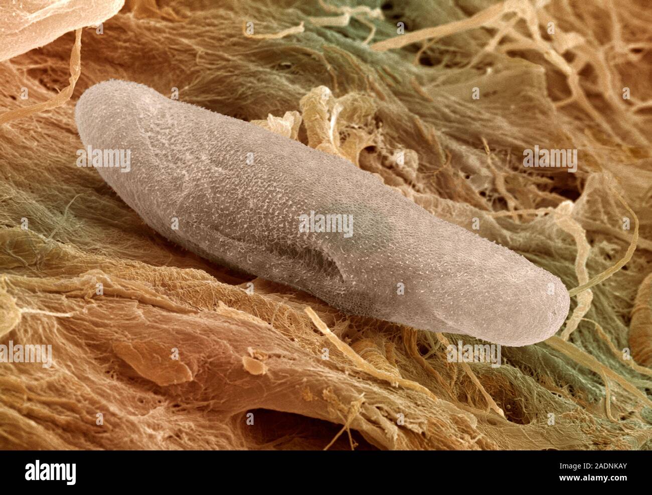 Paramecium. Coloured scanning electron micrograph (SEM) of the single ...