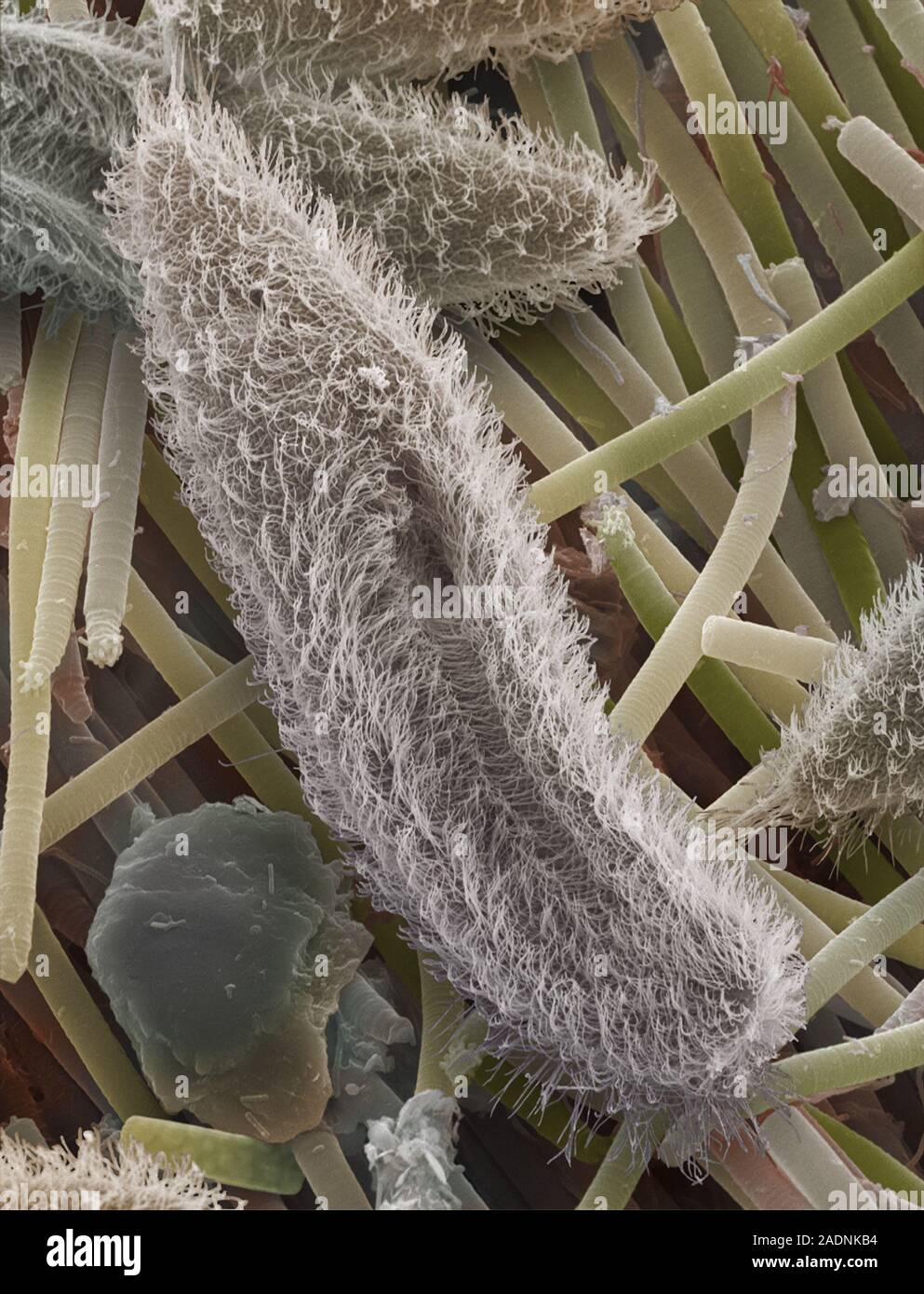 Paramecium protozoa. Coloured scanning electron micrograph (SEM) of ...