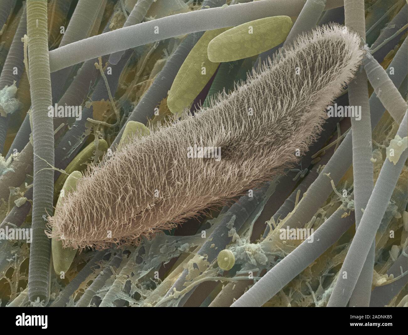 Paramecium protozoan. Coloured scanning electron micrograph (SEM) of a ...