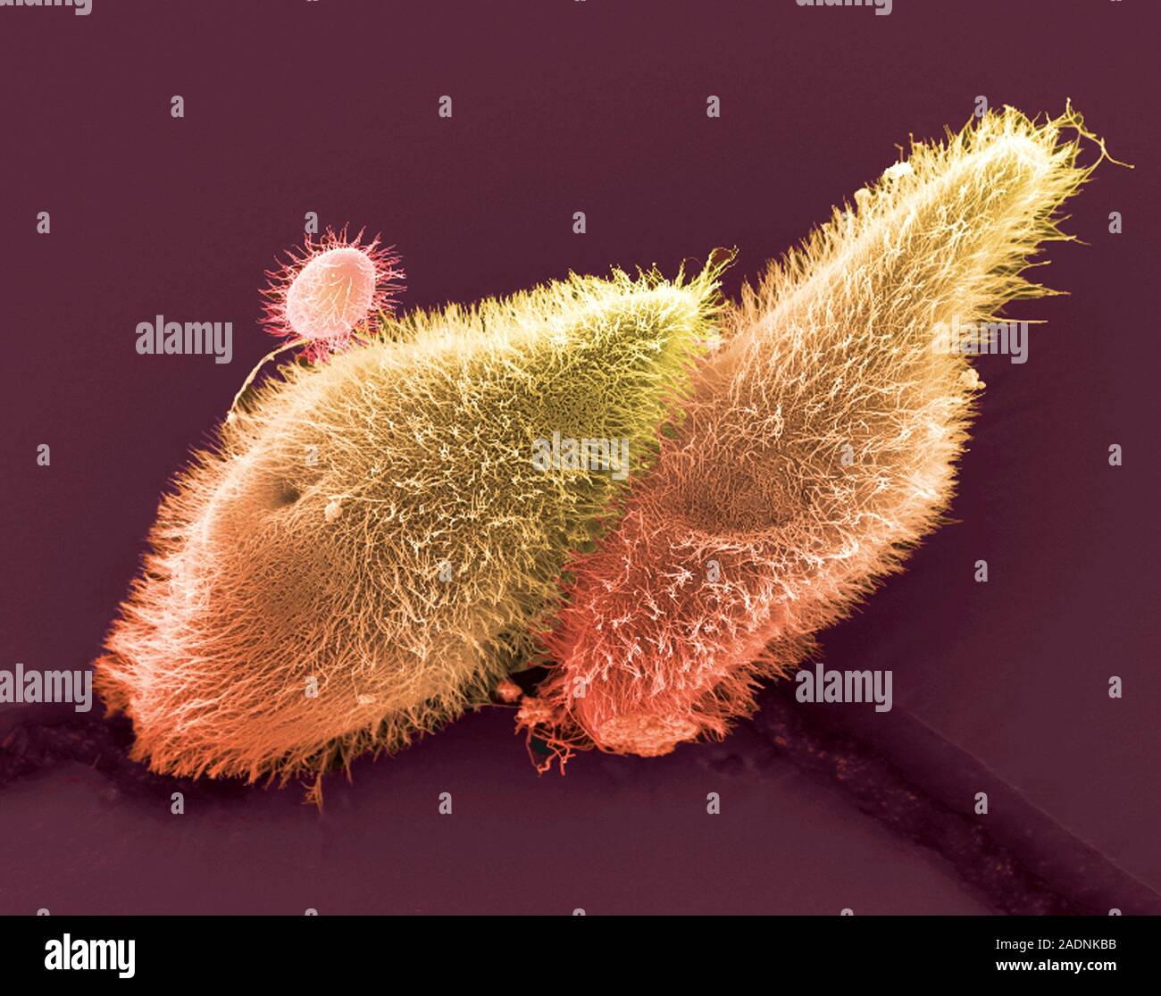 Paramecium protozoa (Paramecium sp.), coloured scanning electron ...