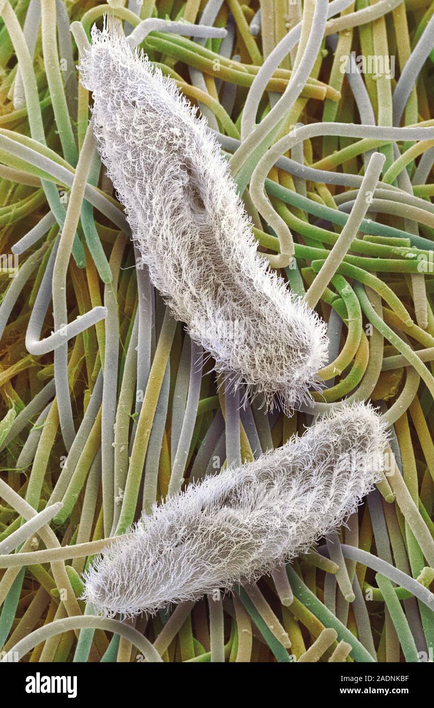 Paramecium protozoa. Coloured scanning electron micrograph (SEM) of two ...