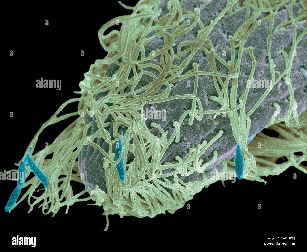 Alga-covered protozoan, coloured scanning electron micrograph (SEM ...