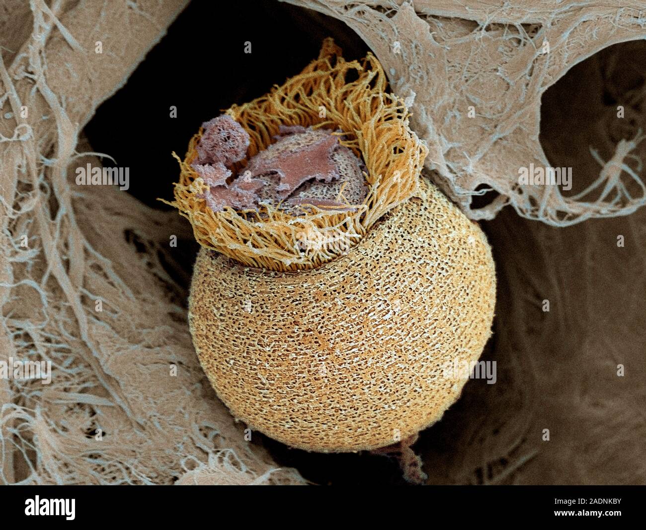 Ciliate protozoan. Coloured scanning electron micrograph (SEM) of a ...