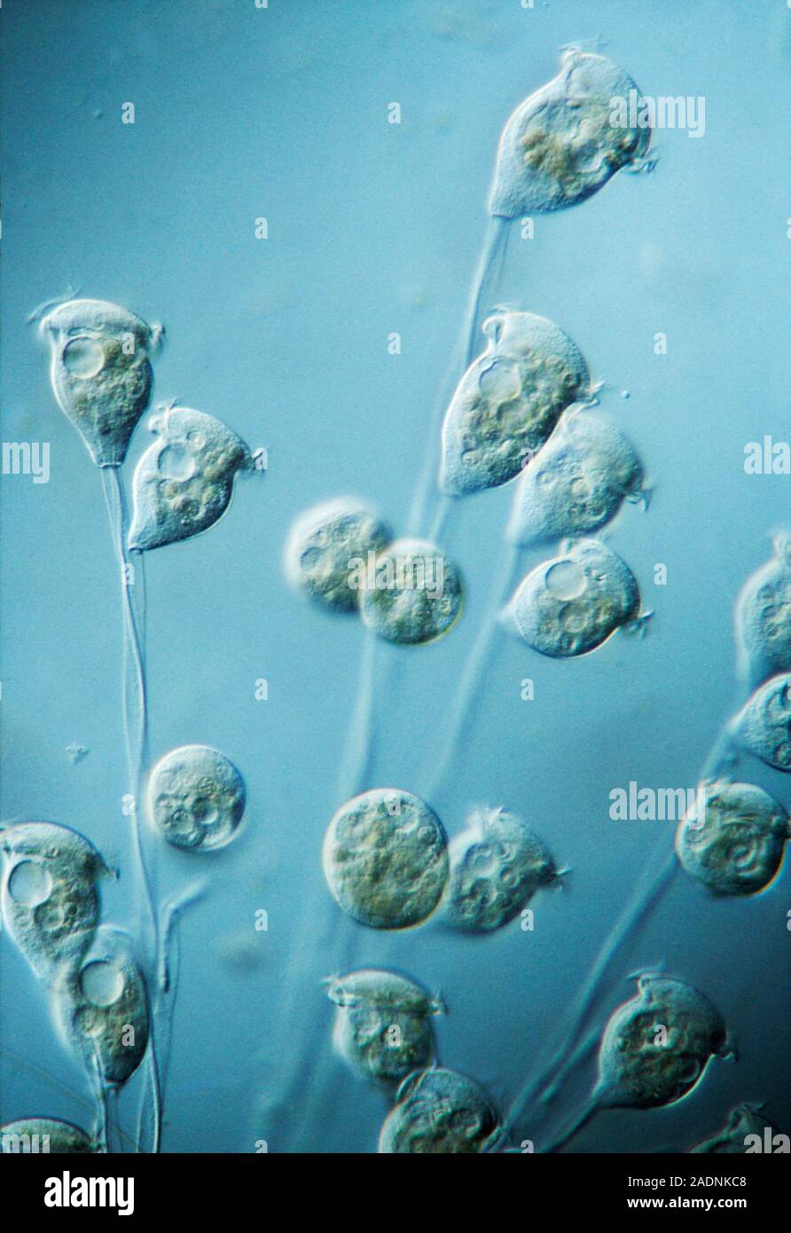 Vorticella protozoa (Vorticella sp.), interference contrast light ...