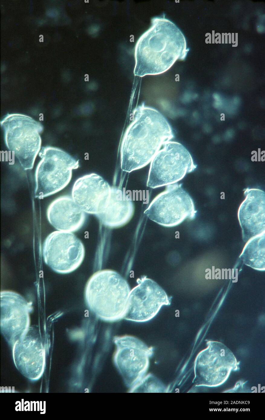 Vorticella protozoa (Vorticella sp.), interference contrast light ...