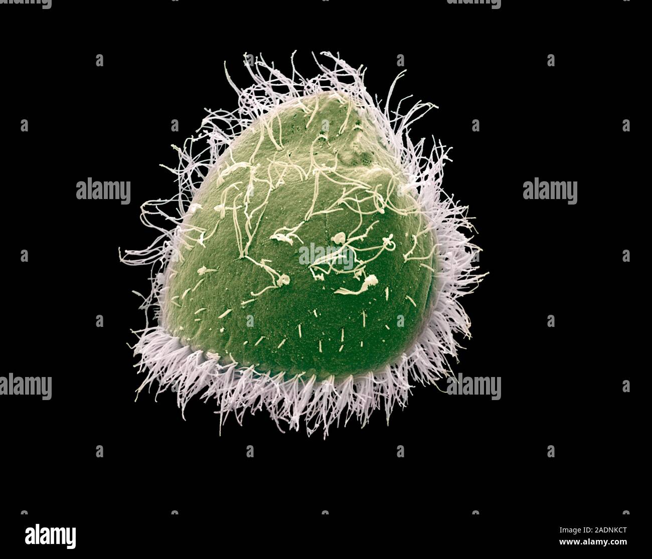 Blepharisma ciliate protozoan. Coloured scanning electron micrograph ...