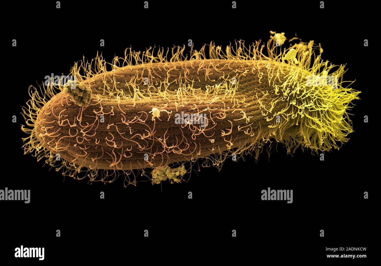 Paramecium protozoan. Coloured scanning electron micrograph (SEM) of a ...