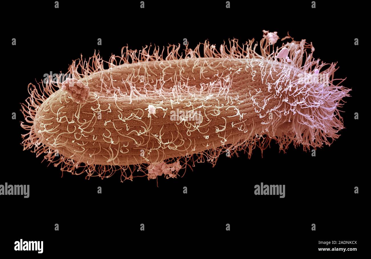 Paramecium protozoan. Coloured scanning electron micrograph (SEM) of a ...