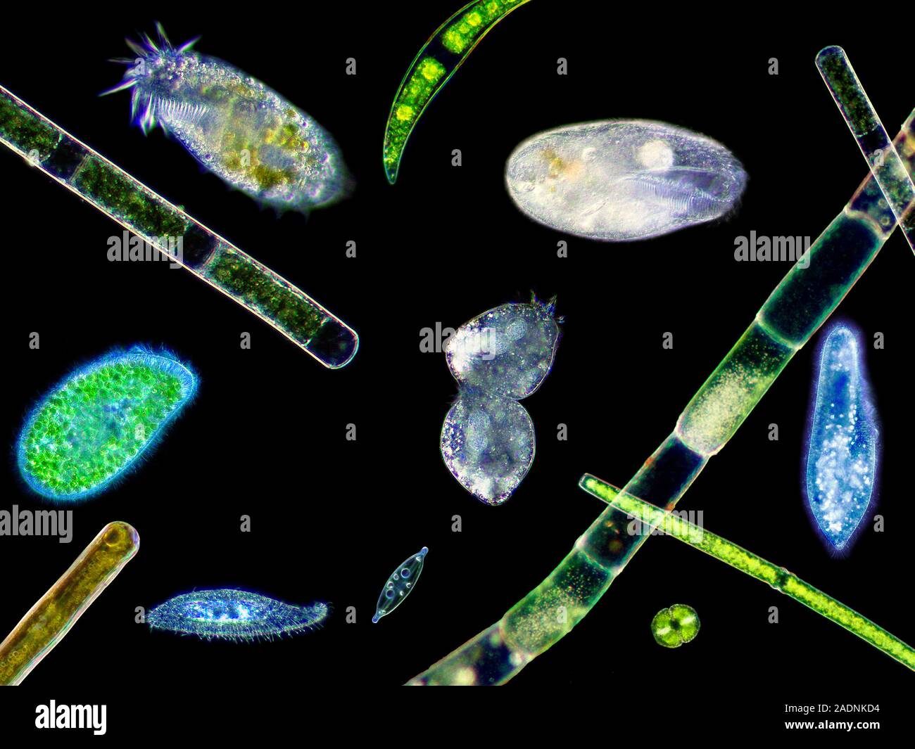 Ciliate protozoa. Light micrograph of a mixed population of freshwater ...