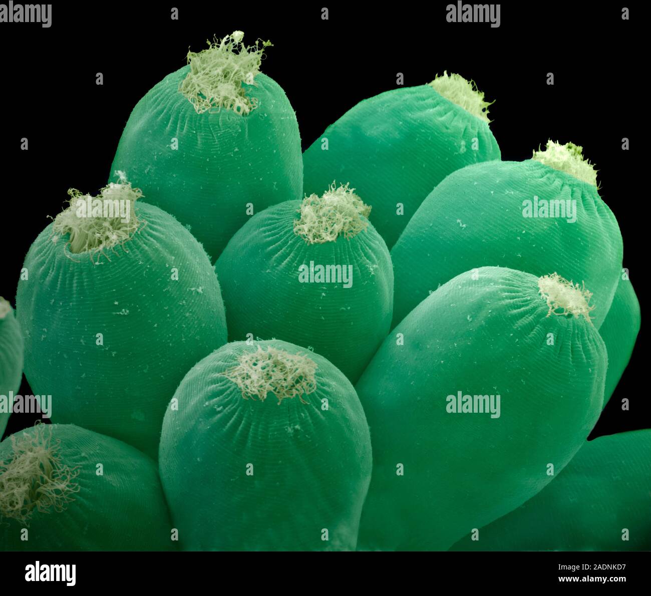 Ciliate protozoans. Coloured scanning electron micrograph (SEM) of ...